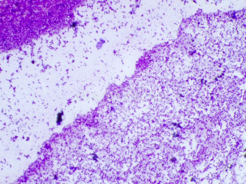 Coryneform Bacterium stock image. Image of laboratory - 351328087