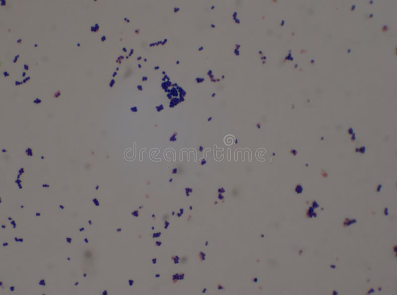 Gram Stain Gram Positive Cocci Stock Photo - Image of healthcare ...