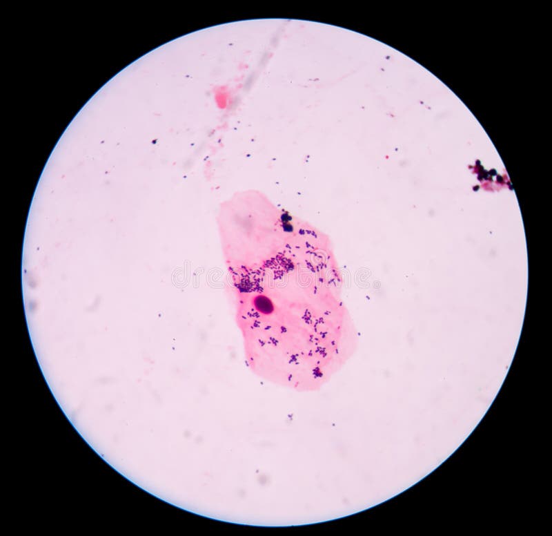 Gram Staining, Also Called Gram S Method, is a Method of Differe Stock ...