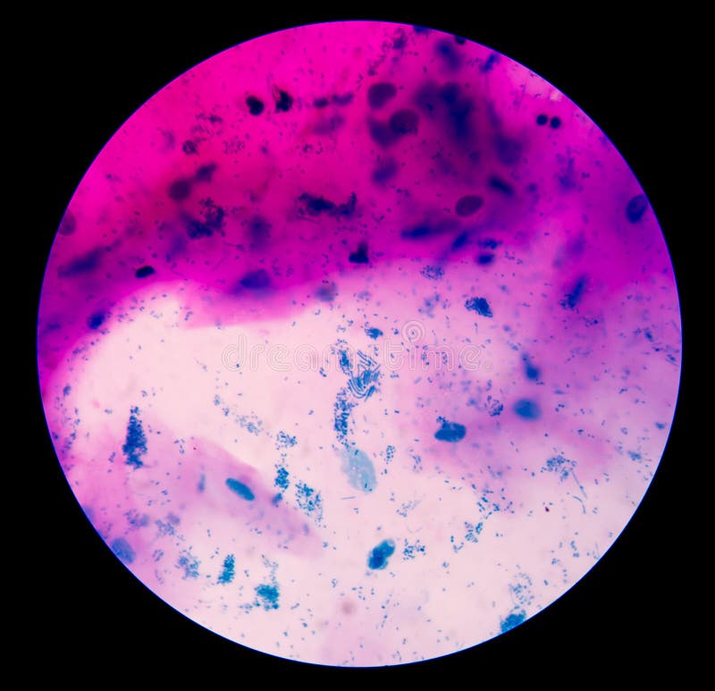 Gram Staining, Also Called Gram S Method, is a Method of Differe Stock ...