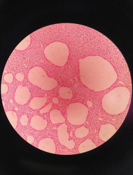 Gram Staining , is a Method of Differentiating Bacterial Species. Gram ...