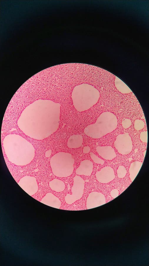 Gram Staining , is a Method of Differentiating Bacterial Species. Gram ...