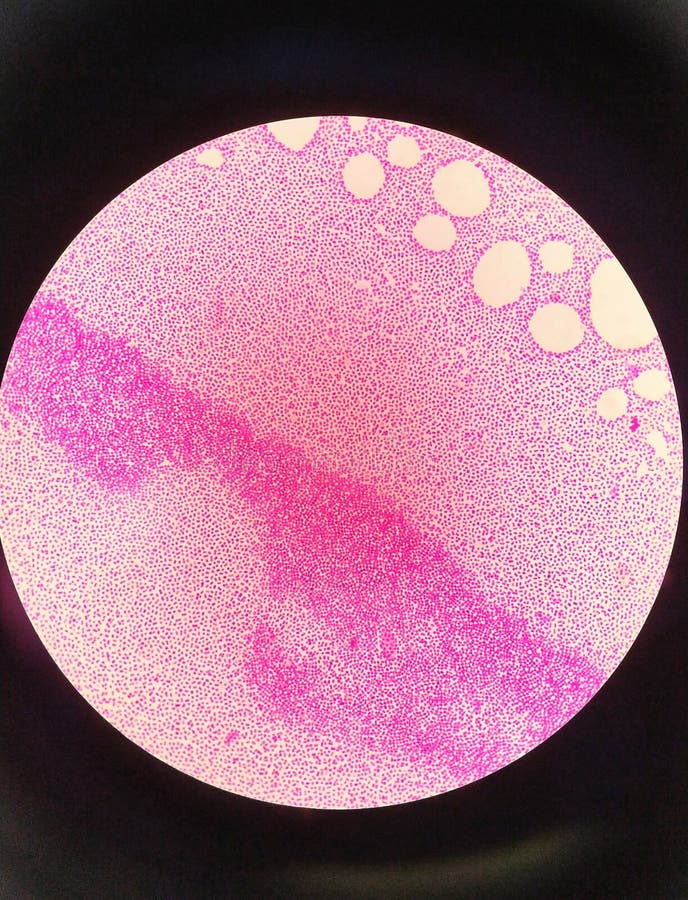 Gram Staining , is a Method of Differentiating Bacterial Species. Gram ...