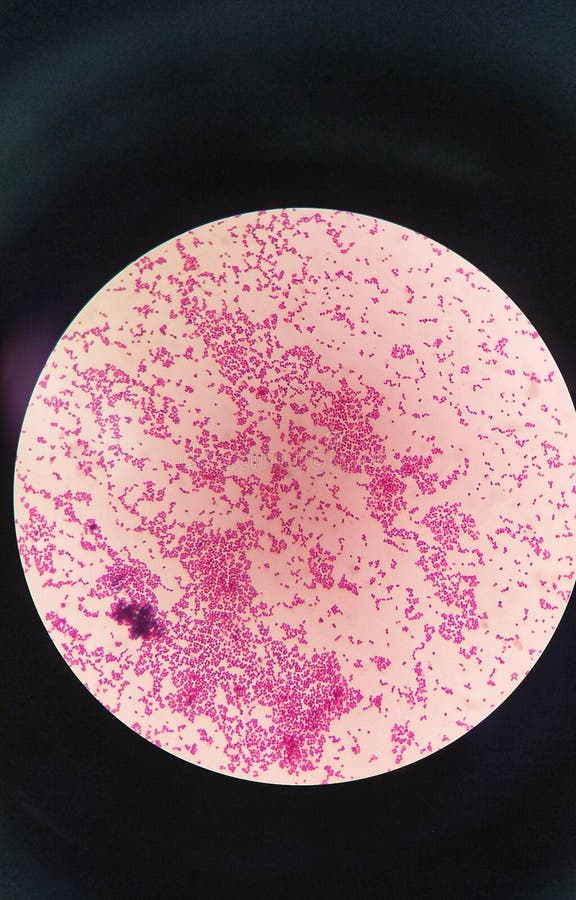 Gram Stain E Coli