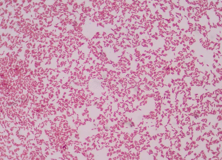 Gram Staining Stock Photos - Free & Royalty-Free Stock Photos from ...