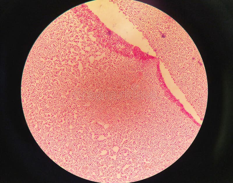 Gram Staining , is a Method of Differentiating Bacterial Species. Gram ...