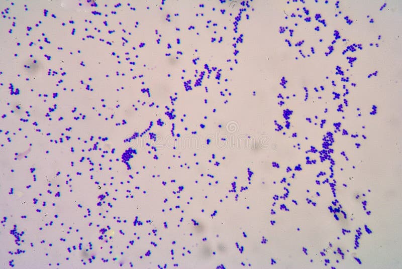 Gram staining stock photo. Image of organic, organism - 49323530