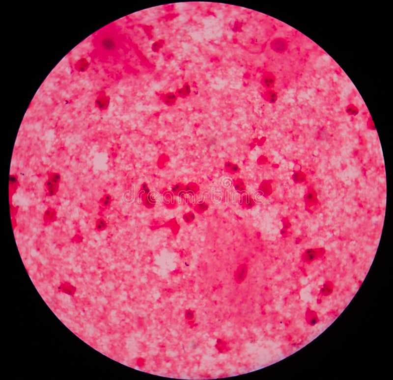 Gram staining stock image. Image of gleam, step, blur - 12574815