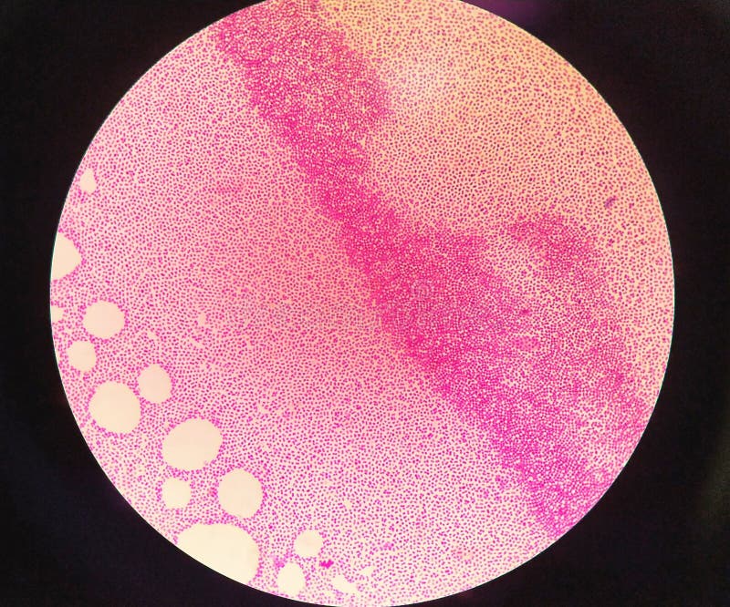 Gram Staining , is a Method of Differentiating Bacterial Species. Gram ...