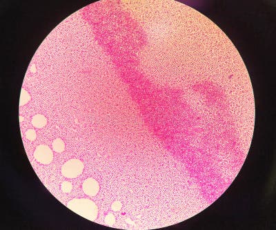 Gram Staining , is a Method of Differentiating Bacterial Species. Gram ...
