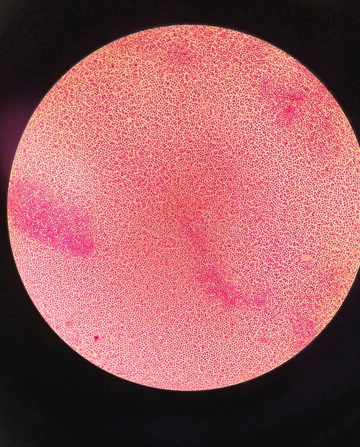 Gram Staining , is a Method of Differentiating Bacterial Species. Gram ...