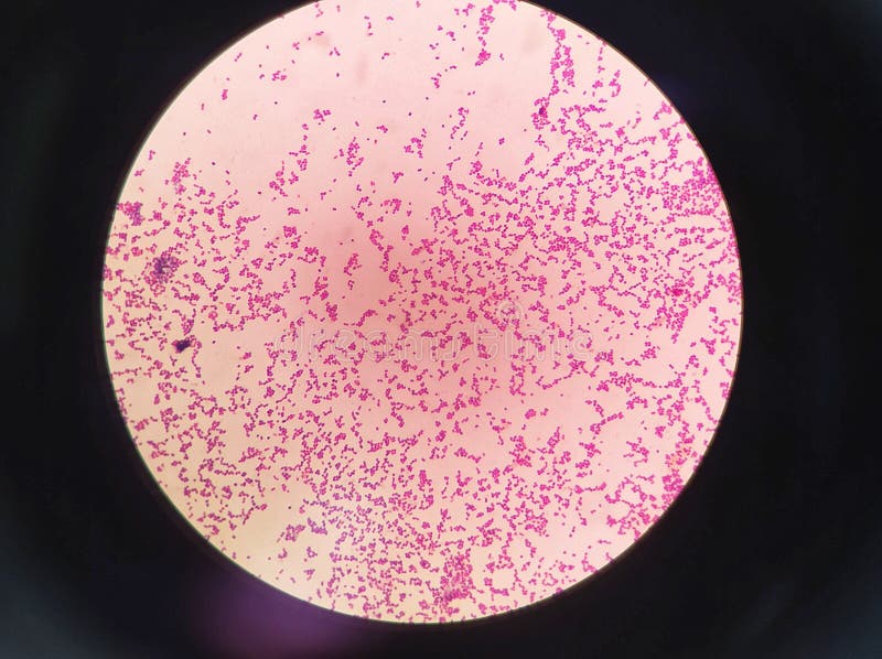 Gram Staining , is a Method of Differentiating Bacterial Species. Gram ...