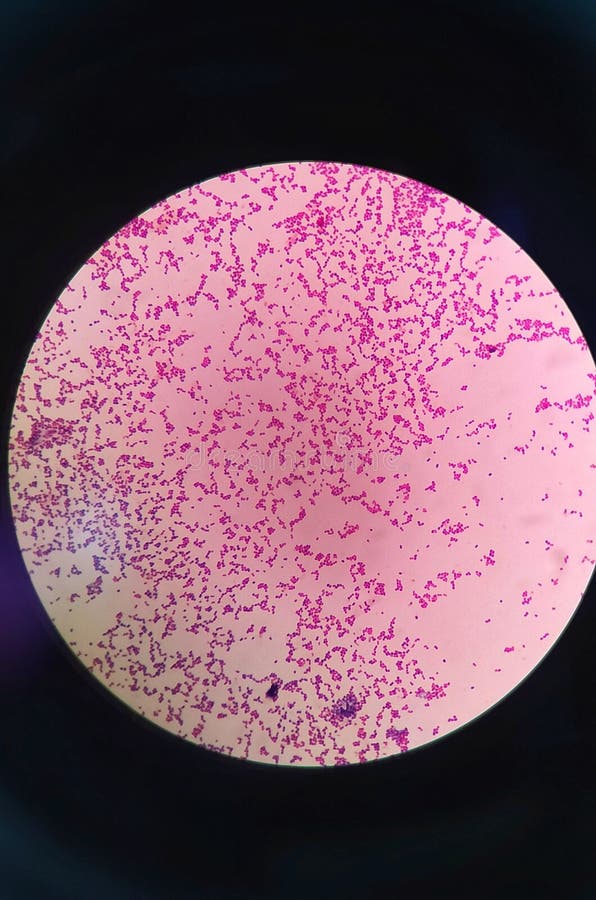 Gram Staining ,gram Positive Coccus Stock Image - Image of design ...