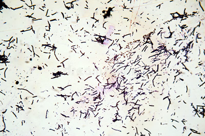 Gram Stain Test Showing Bacteria Cells. Stock Photo - Image of colony ...
