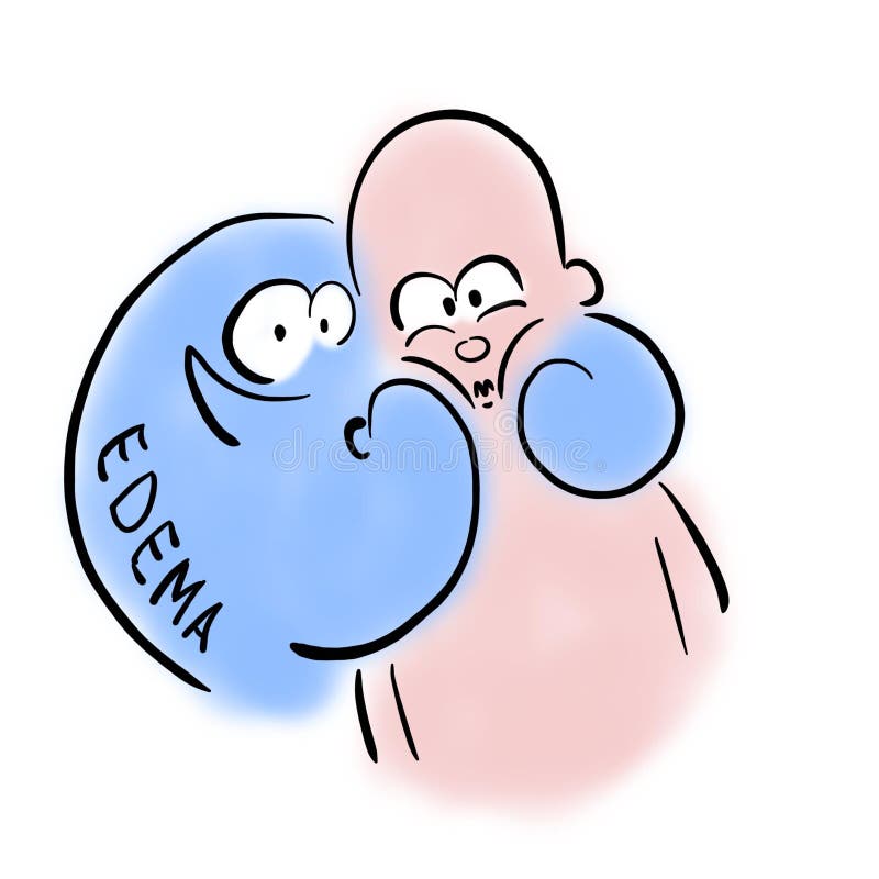 Grand Homme Avec Le Gonflement Du Visage Illustration Stock ...