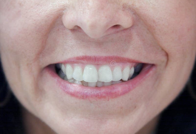 Smile Photos Stock Gratuites & Images, Smile Libre des droits et ...