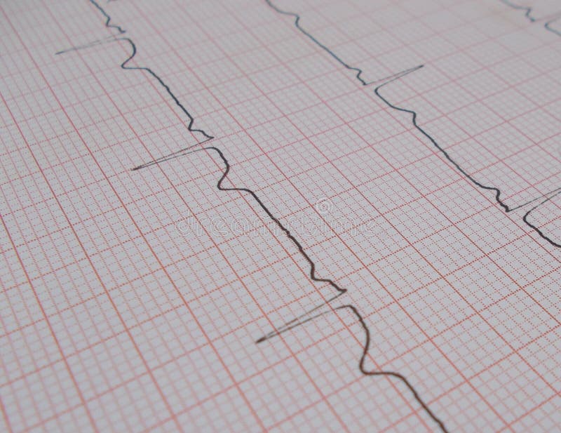 Electrocardiogram stock photo. Image of health, amplitude - 123558306