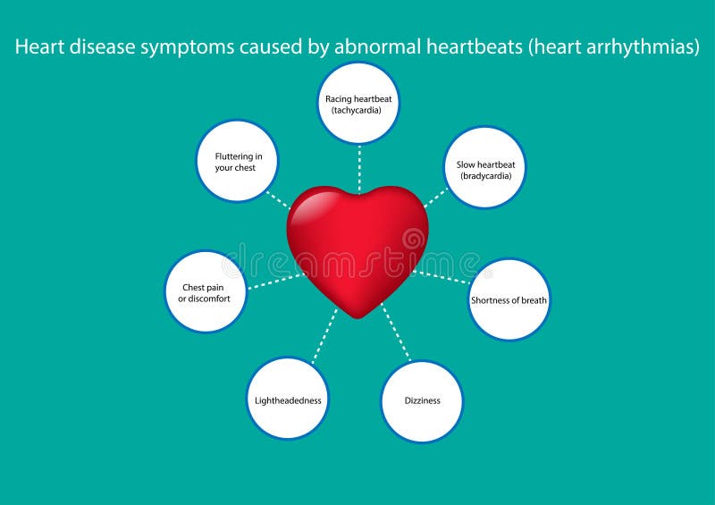 GRAPHICS DRAWING CONCEPT Heart Disease Symptoms Caused by Abnormal ...