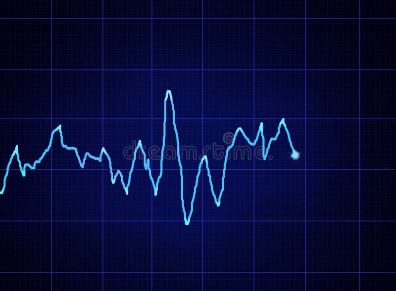 Graphique Normal Du Battement De Coeur ECG Illustration Stock ...