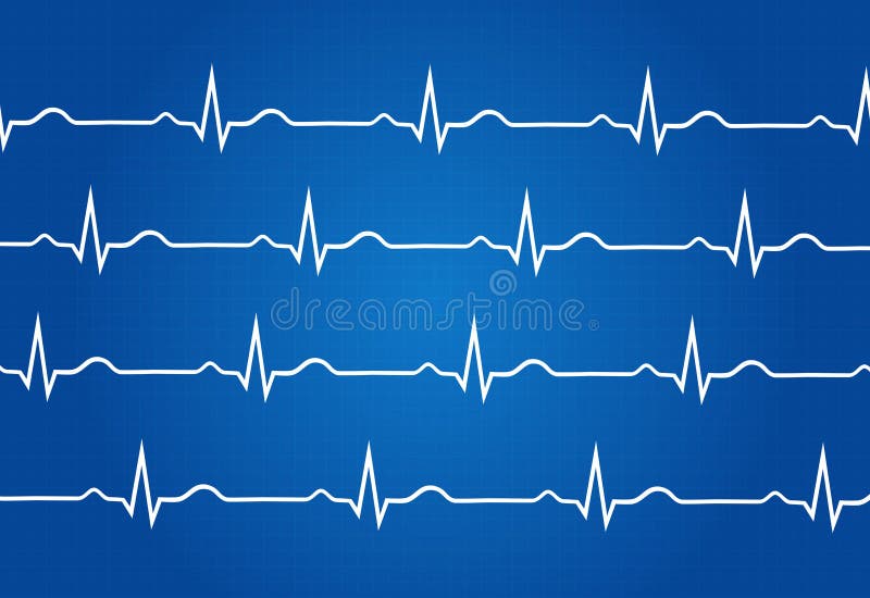 Graphique Normal D'électrocardiogramme Illustration de Vecteur ...
