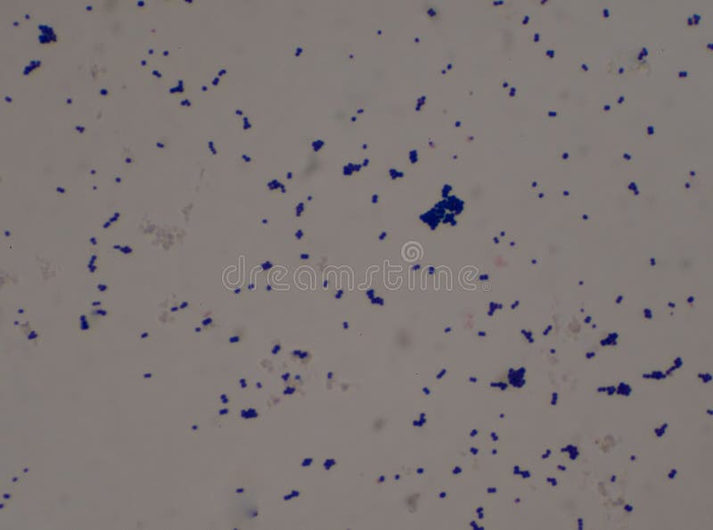 Grasa gramo coco positivo imagen de archivo. Imagen de epidemia - 207217755