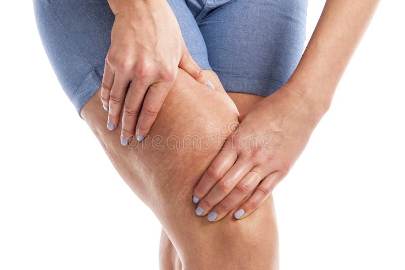 Grasa Y Celulitis En Las Piernas Foto de archivo - Imagen de hermoso ...