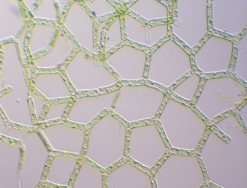 Green Algae at High Magnification Stock Photo - Image of organisms ...