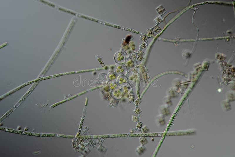 Red Algae Under the Microscope Stock Photo - Image of tissue, 100x ...