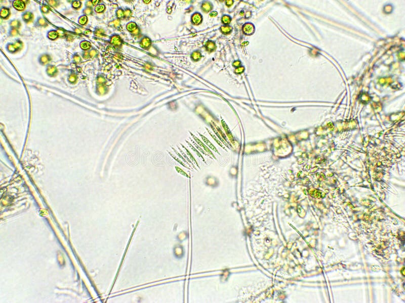 Green Algae Under Microscopic View, Chlorophyta Stock Image - Image of ...