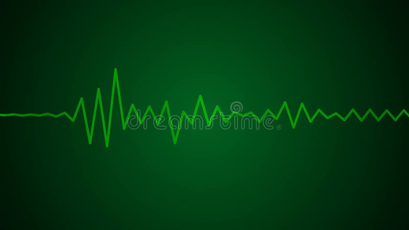 Audio Wave Drawing 2D Animation Stock Footage - Video of animated ...