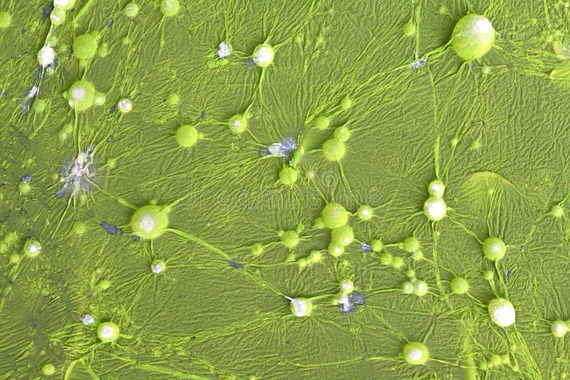 Green Bacteria Colony Forming Bubbles on Contaminated Sewage Water ...