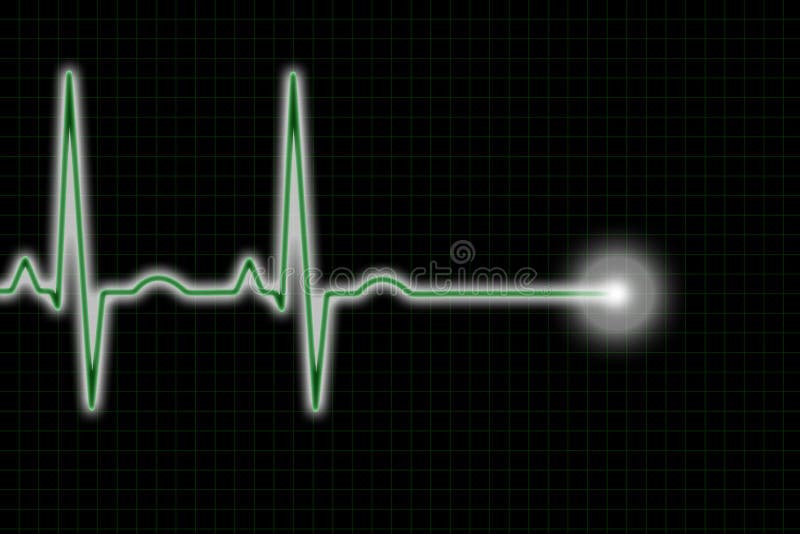 Green and Black ECG Trace stock illustration. Illustration of blood ...