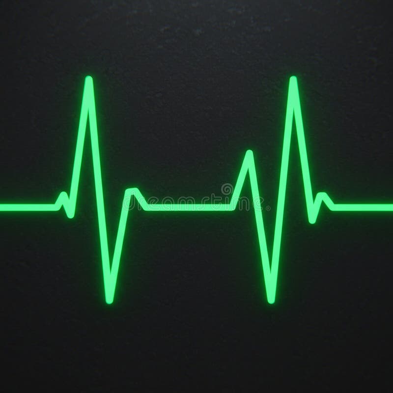 Ecg Waveform, Normal Atrial and Ventricular Depolarization with ...