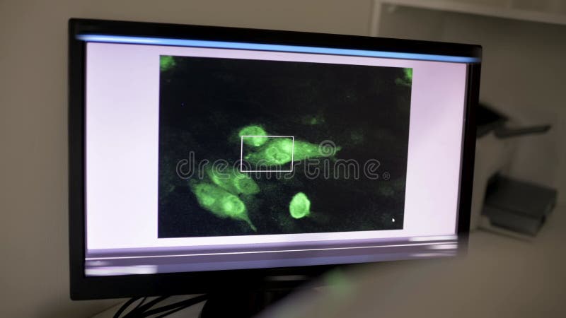 Green Molecules of a Virus or Bacteria Under a Modern Electron ...