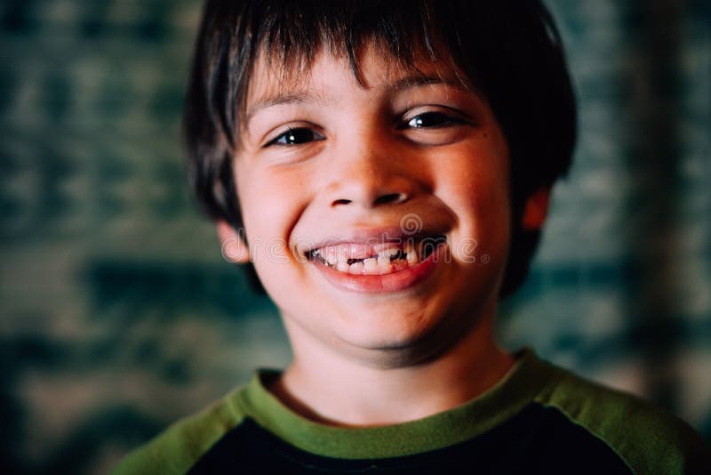 Grinning boy missing teeth stock image. Image of haired - 63854159