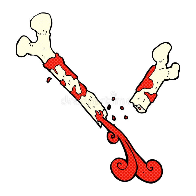 Cartoon broken bone stock vector. Illustration of artwork - 67011266