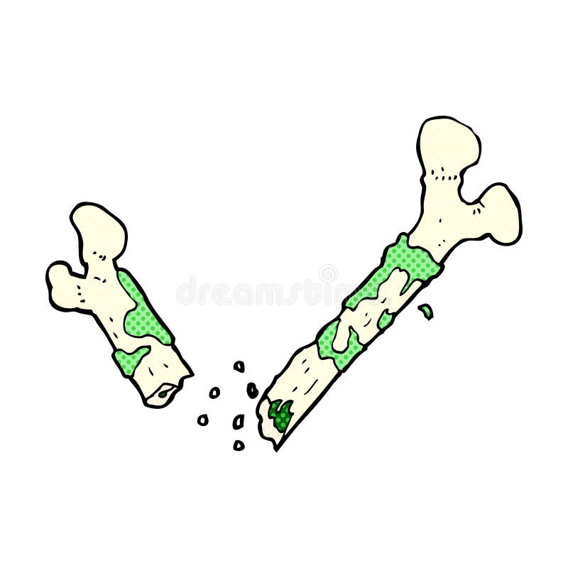 Broken Bone Cartoon Stock Illustrations – 2,386 Broken Bone Cartoon ...