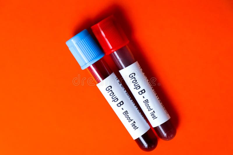 Group B - Blood Test, Blood Sample To Analyze in the Laboratory Stock ...