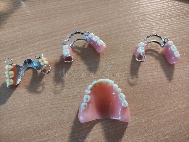 Group of Dentures on the Table at the Dentist in the Dental Office ...