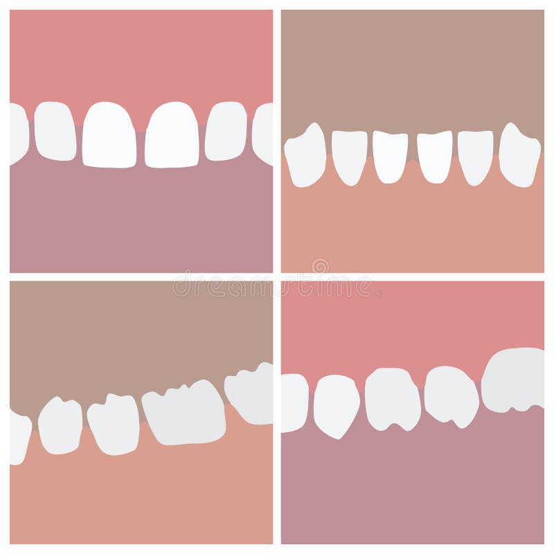 Teeth Segments Vector Stock Illustrations – 13 Teeth Segments Vector ...