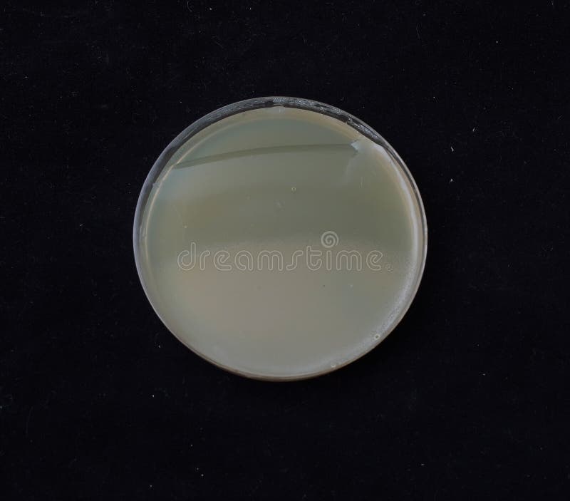 Growth of Bacterial Colonies on Antibiotic Gradient Agar Stock Photo ...