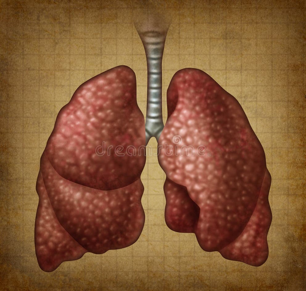 Grunge Human Anatomy Stock Illustrations – 1,932 Grunge Human Anatomy ...