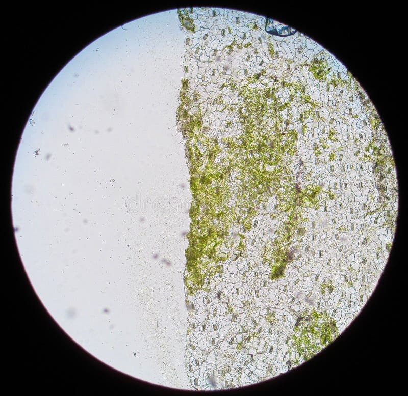 Frontonia Sp. Unicellular Ciliate Protists Under the Microscope. Stock ...