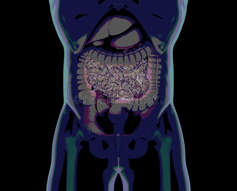 Gut Bacteria , Gut Flora, Microbiome. Bacteria Inside the Small ...