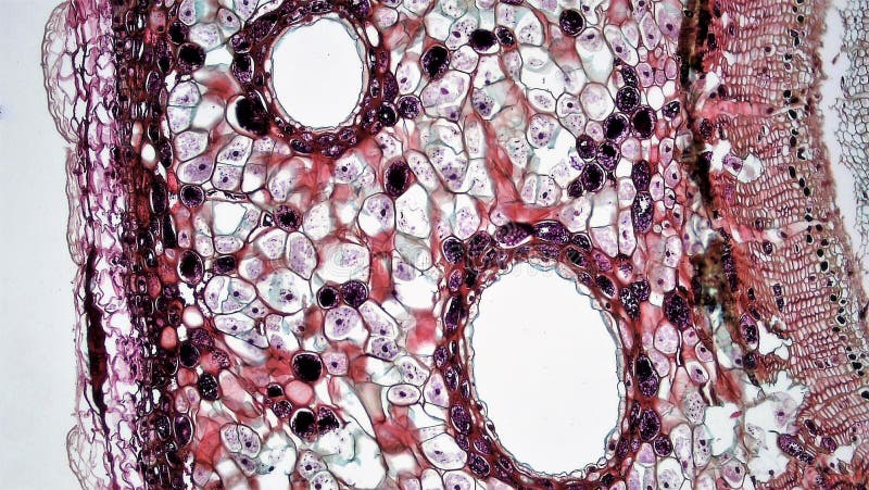 Gymnosperm Stem: Cork And Cortex In Three Year Pinus Stock Photo ...