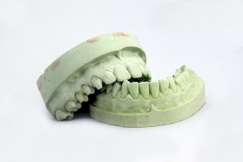 Gypsum model stock image. Image of ceramist, area, insert - 7148839