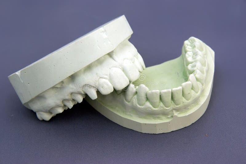 Gypsum model stock photo. Image of hard, easy, dentist - 7234954