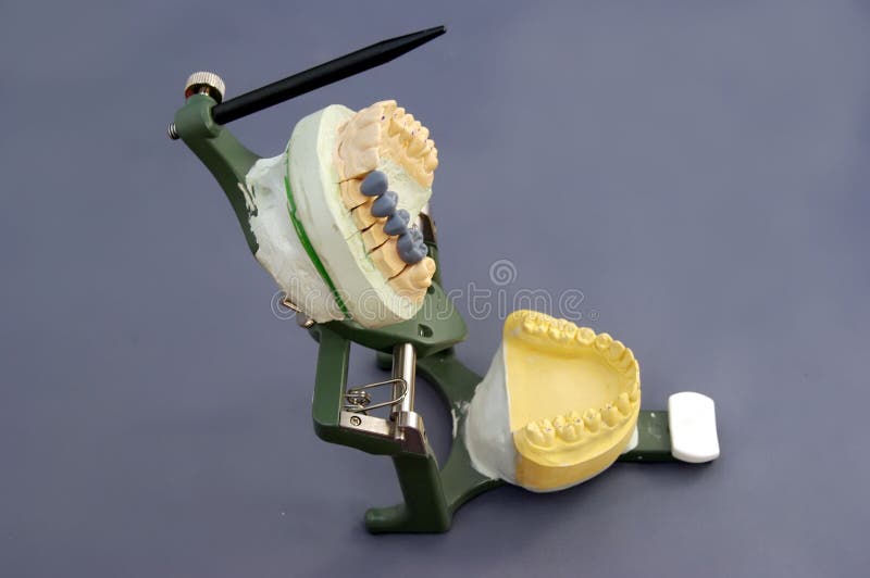 Gypsum model stock photo. Image of dentistry, aluminum - 7234956