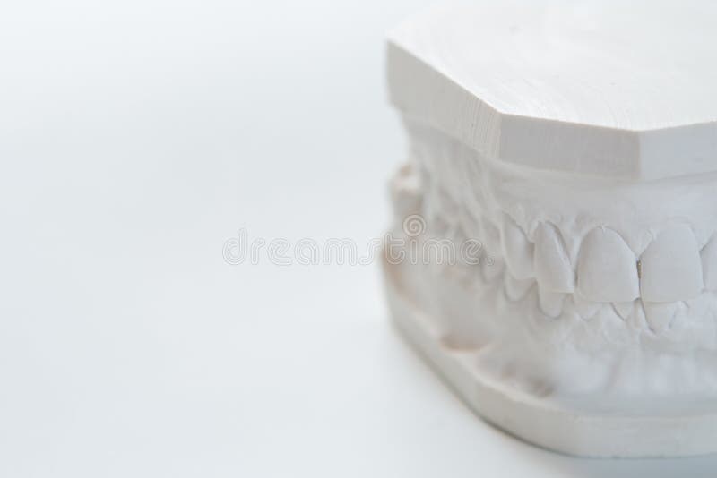 Gypsum Model of Human Jaw on a White Background. Stock Image - Image of ...