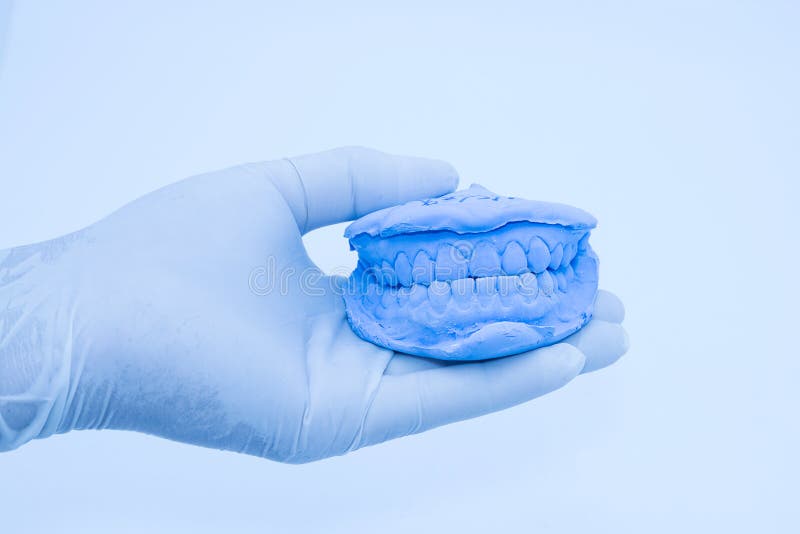 Gypsum Model Plaster On Hand Stock Image - Image of black, biology ...